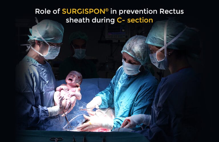 Role of SURGISPON® in prevention of rectus sheath hematomas in C ...